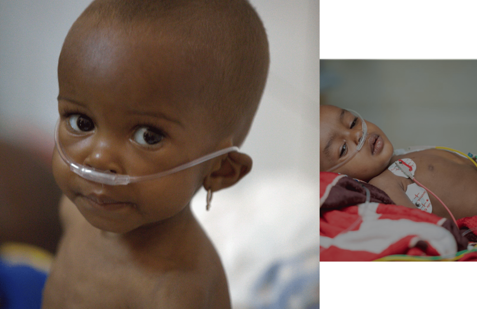 Provide Medical Oxygen | SAPA USA