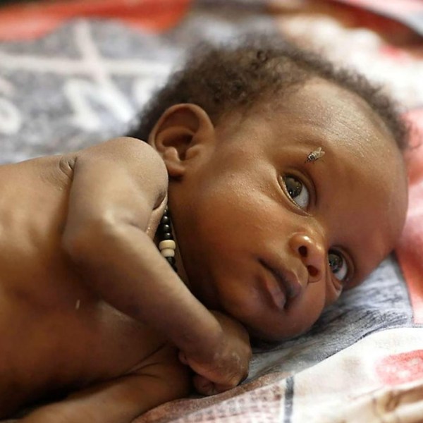 Effects of Child Hunger - How Does Food Insecurity Affect Children?